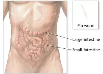 Cacing pin Usus besar Usus kecil